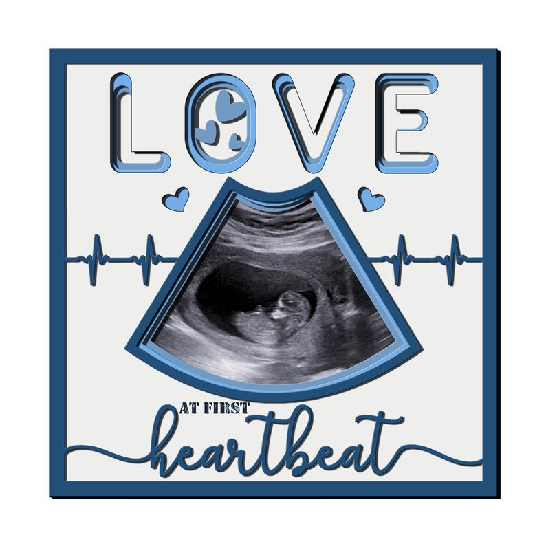 3D Baby Ultrasound Shadow Box SVG, Ultrasound Display Multi Layer Svg ...