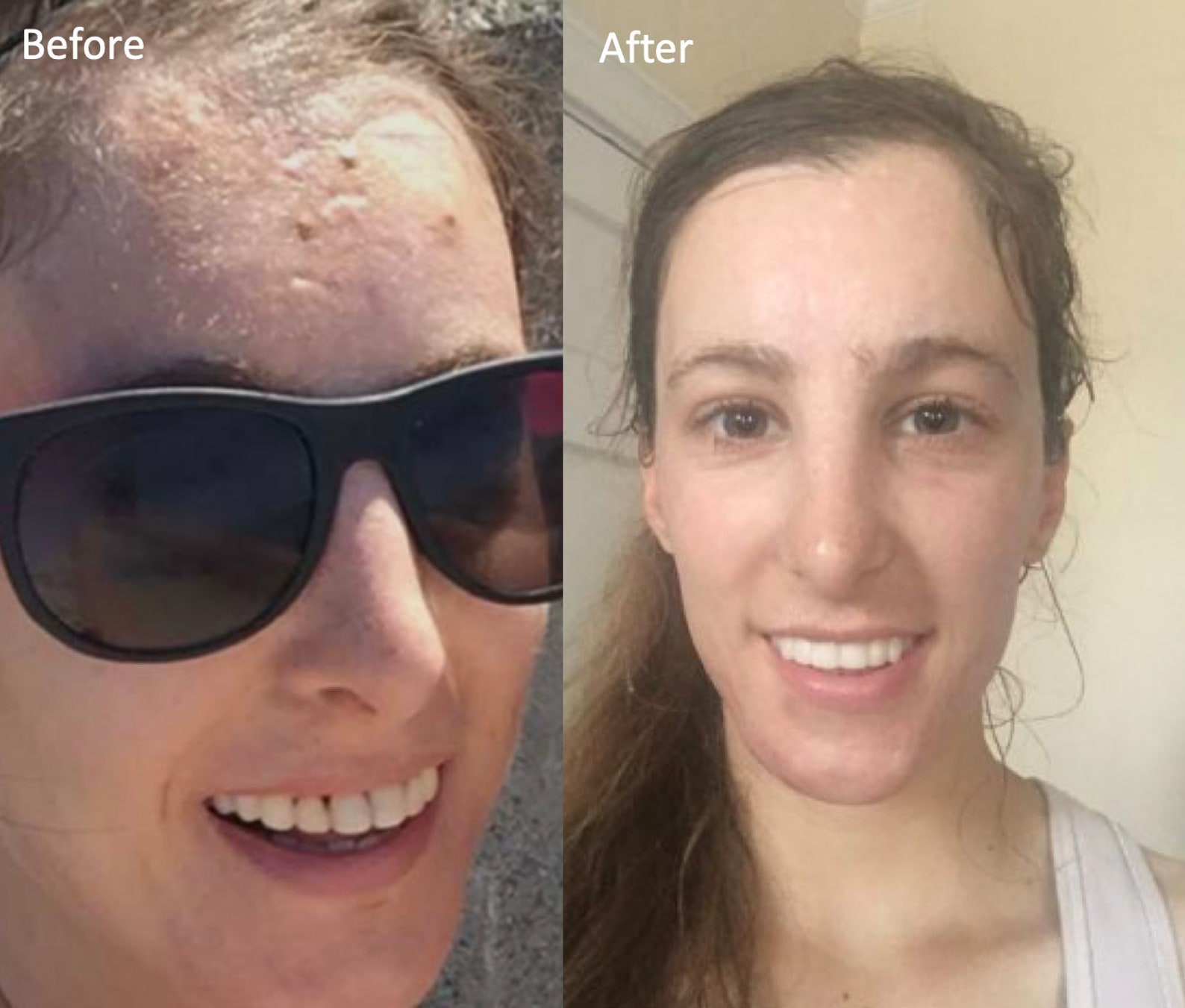 Ghk-cu Copper Peptide Serum, Copper Peptide (ghk-cu) Cream for Scar ...