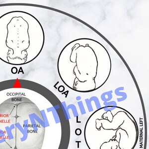 Fetal Position Wheel classic Digital Download PDF - Etsy