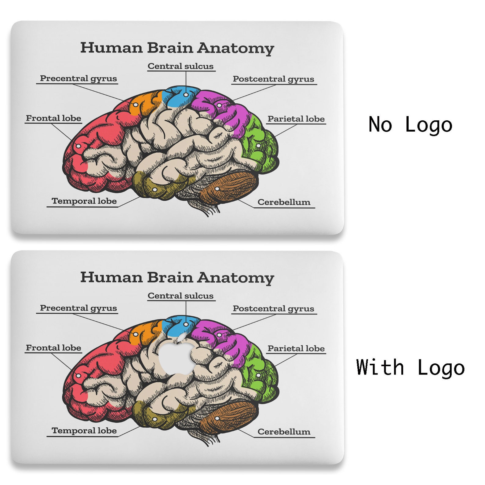 Human Brain Anatomy Macbook M2 Air Case Custom Pro 14 in Case - Etsy