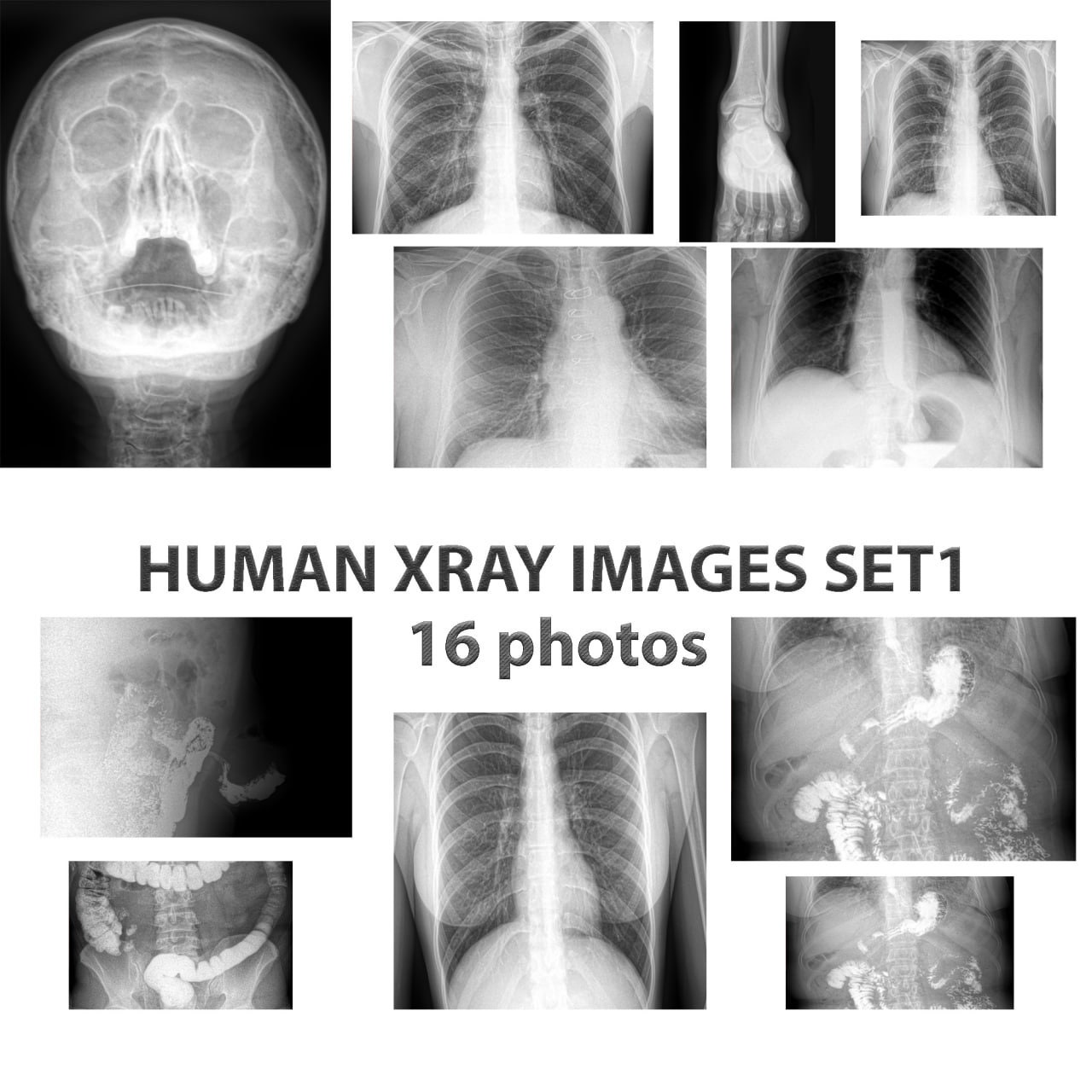 X-ray Images for Posters Xray Printable, X Ray Digital Download, Bones ...