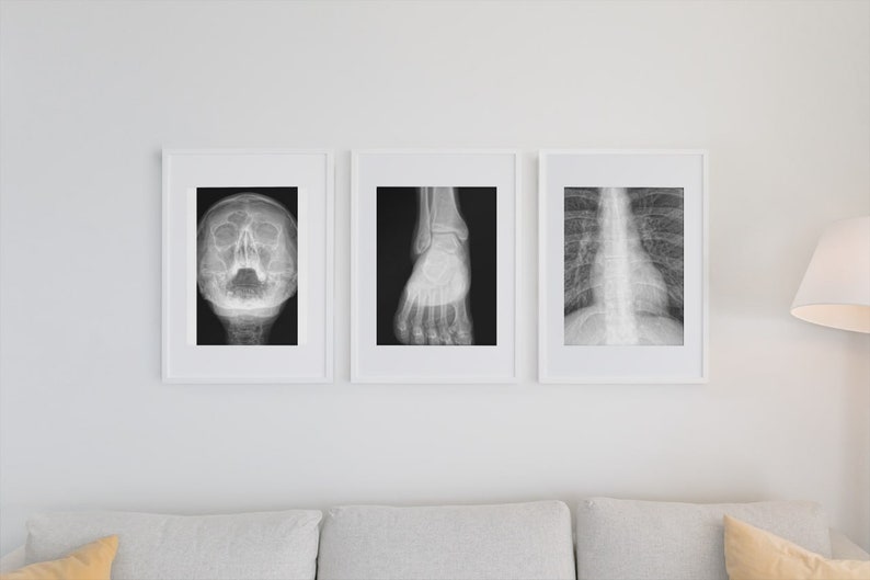 X-ray Images for Posters Xray Printable, X Ray Digital Download, Bones ...