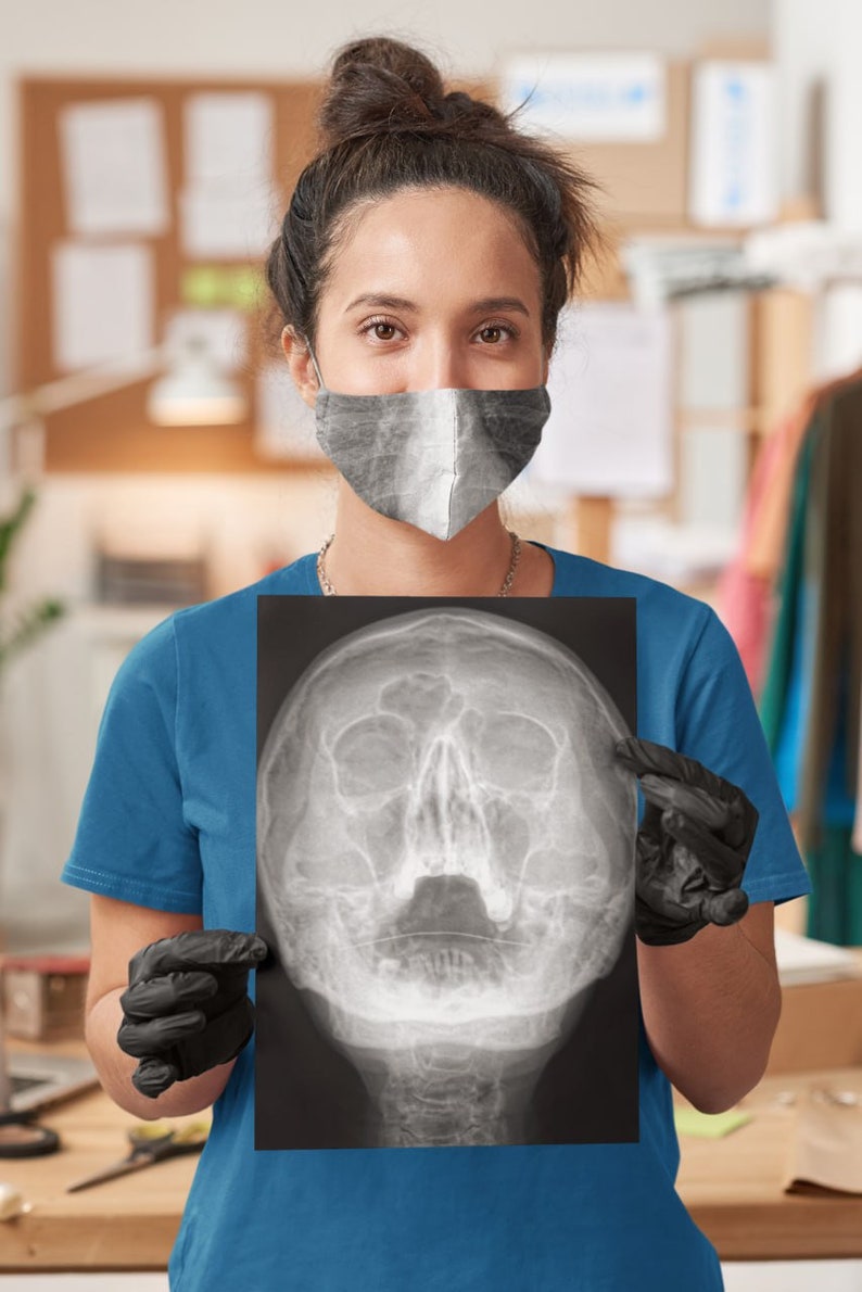 X-ray Images for Posters Xray Printable, X Ray Digital Download, Bones ...