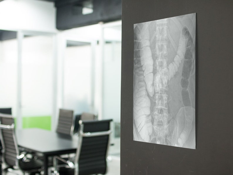 X-ray Images for Posters Xray Printable, X Ray Digital Download, Bones ...