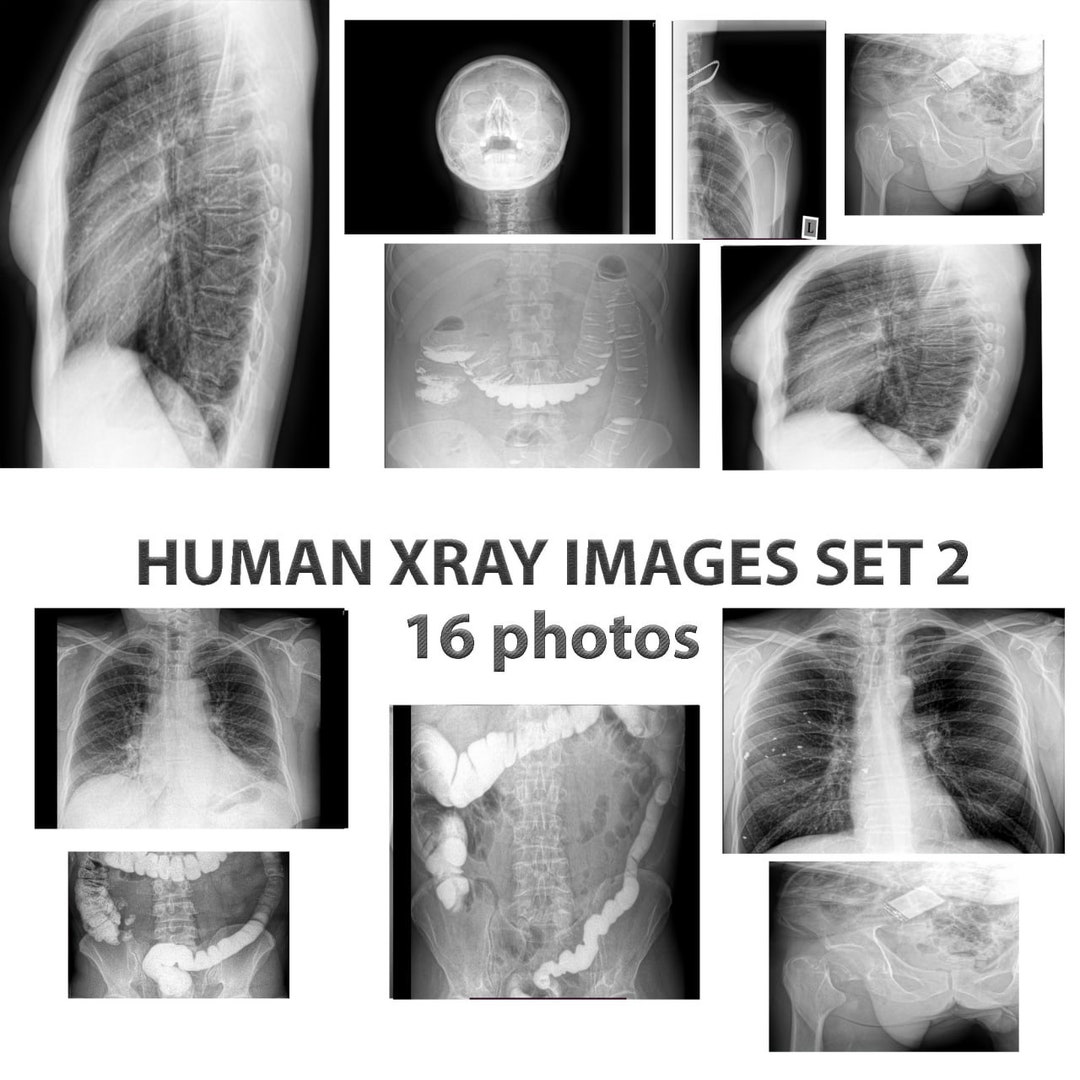X-ray Images for Posters Xray Printable, X Ray Digital Download, Bones ...