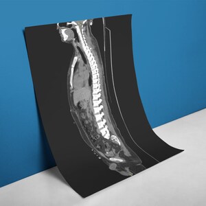 X-ray Images for Posters Xray Printable, X Ray Digital Download, Bones ...