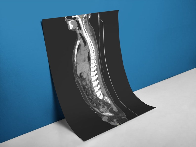 X-ray Images for Posters Xray Printable, X Ray Digital Download, Bones ...