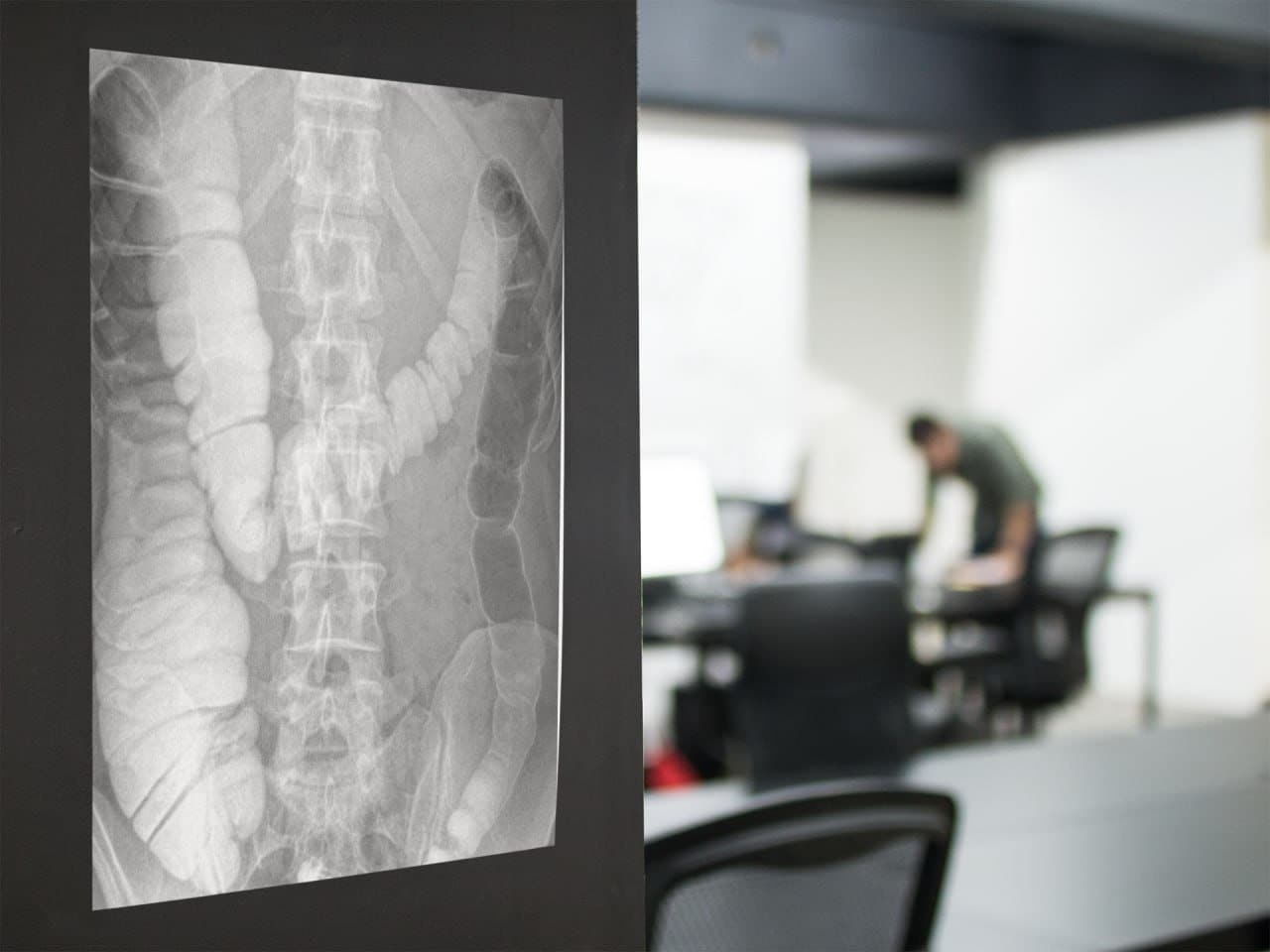 X-ray Images for Posters Xray Printable, X Ray Digital Download, Bones ...
