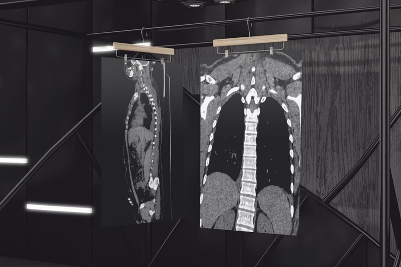 X-ray Images for Posters Xray Printable, X Ray Digital Download, Bones ...