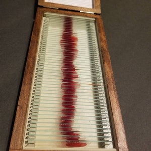 Dexter Blood Slide Box - Etsy