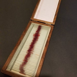 Dexter Blood Slide Box - Etsy
