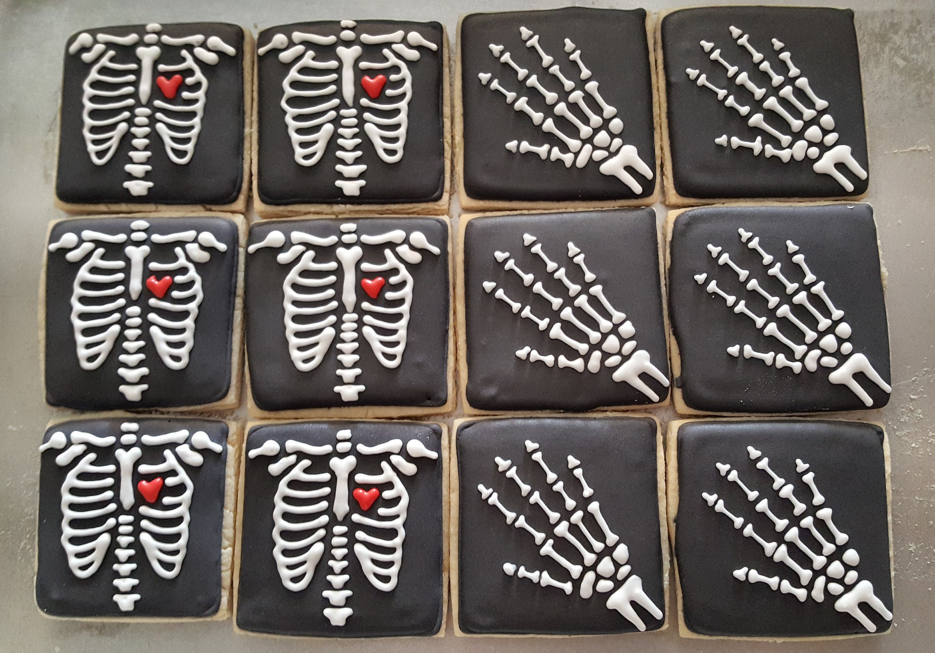 Xray Cookies, Radiology Cookies, Bone Cookies, Skeleton Cookies - Etsy