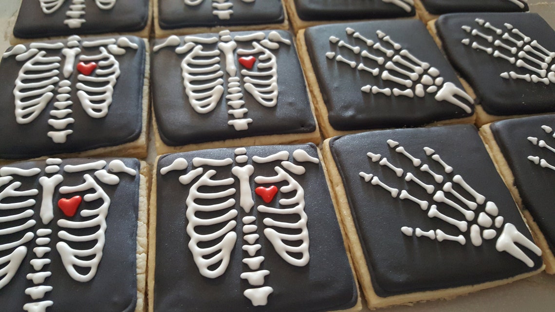 Xray Cookies, Radiology Cookies, Bone Cookies, Skeleton Cookies - Etsy