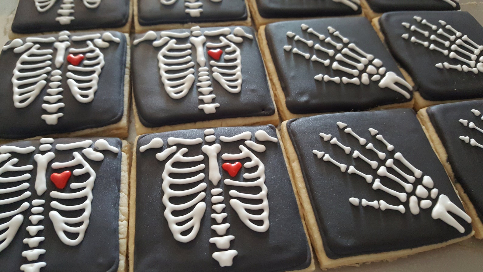 Xray Cookies, Radiology Cookies, Bone Cookies - Etsy