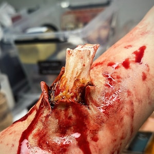 Open Fracture Bone (REUSABLE) - Special Effects Makeup Prop for ...