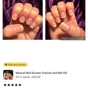 Natural Nail Grower Cuticle and Nail Oil Nail Growth Oil Nail Growth ...