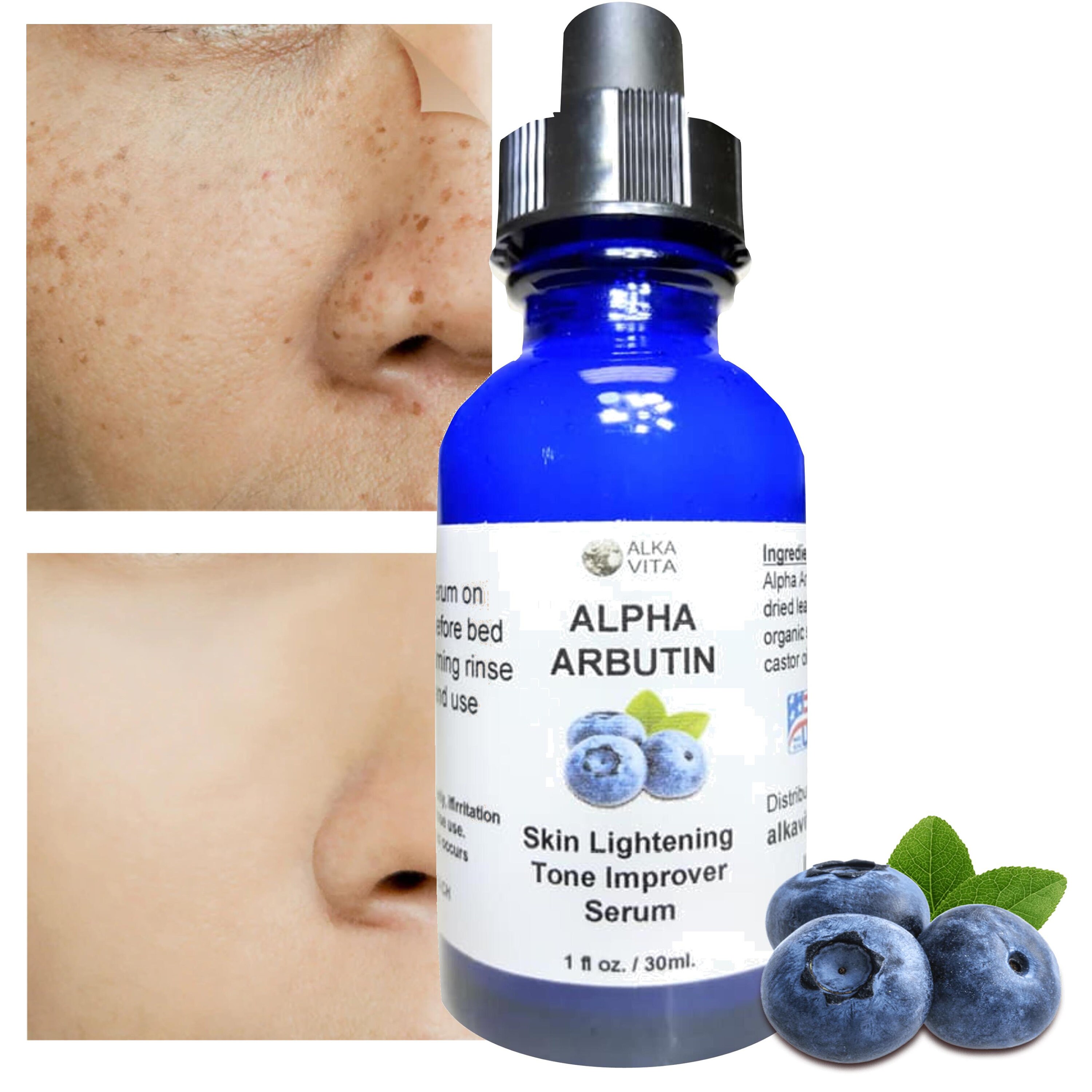 Skin Brightening Alpha Arbutin Blueberry Leaves Facial Serum - Etsy