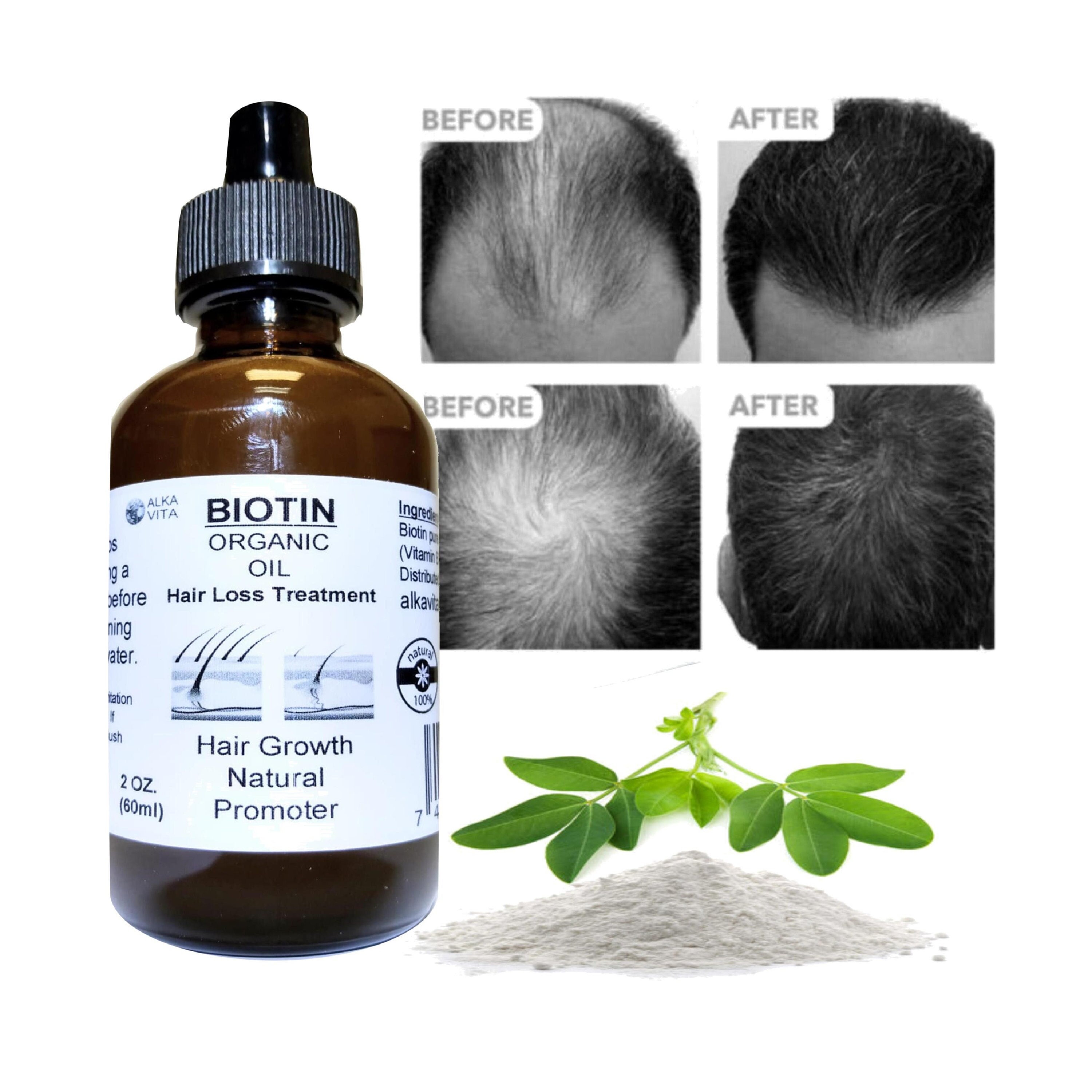 Hair Chemist Biotin Pro-Growth Premium Hair Oil, 53% OFF