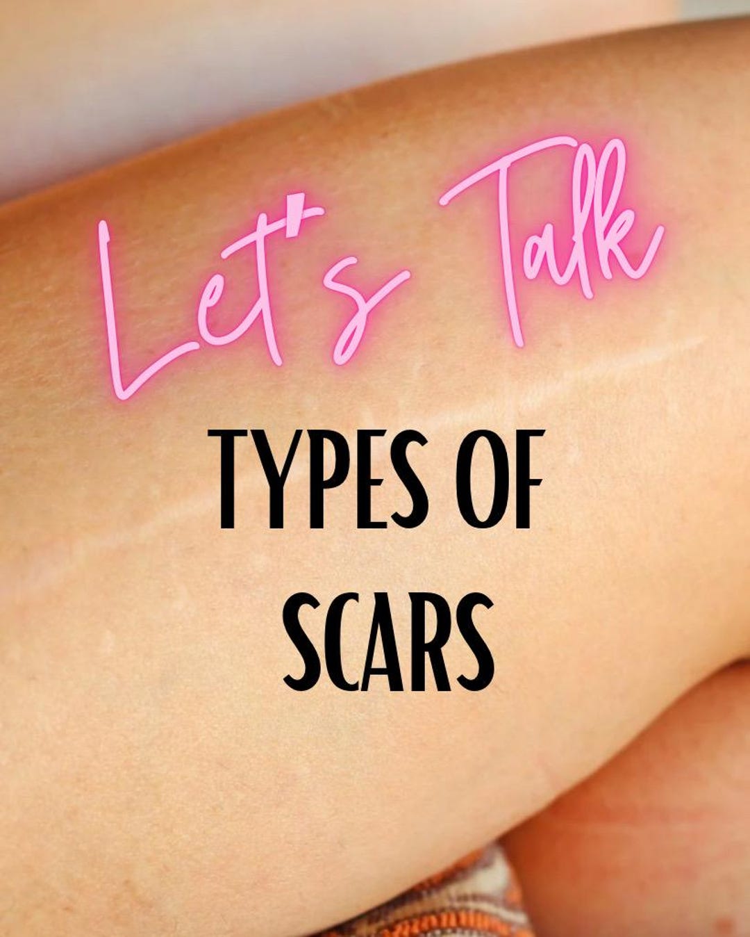 Scar Types Instagram Post Template - Etsy