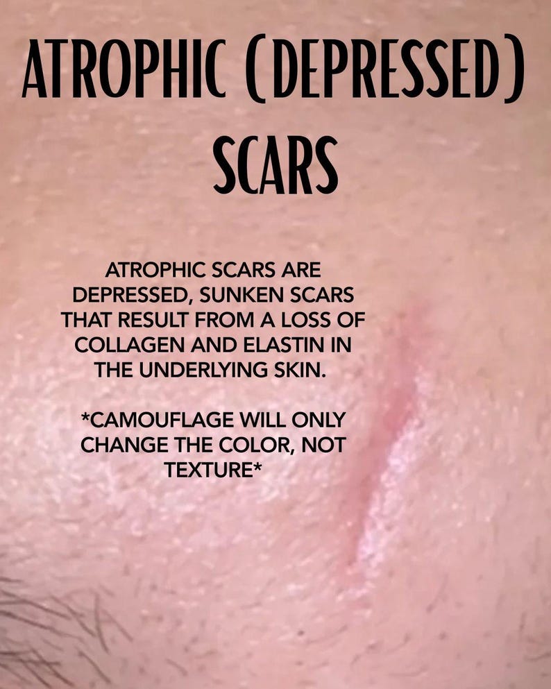 Scar Types Instagram Post Template - Etsy