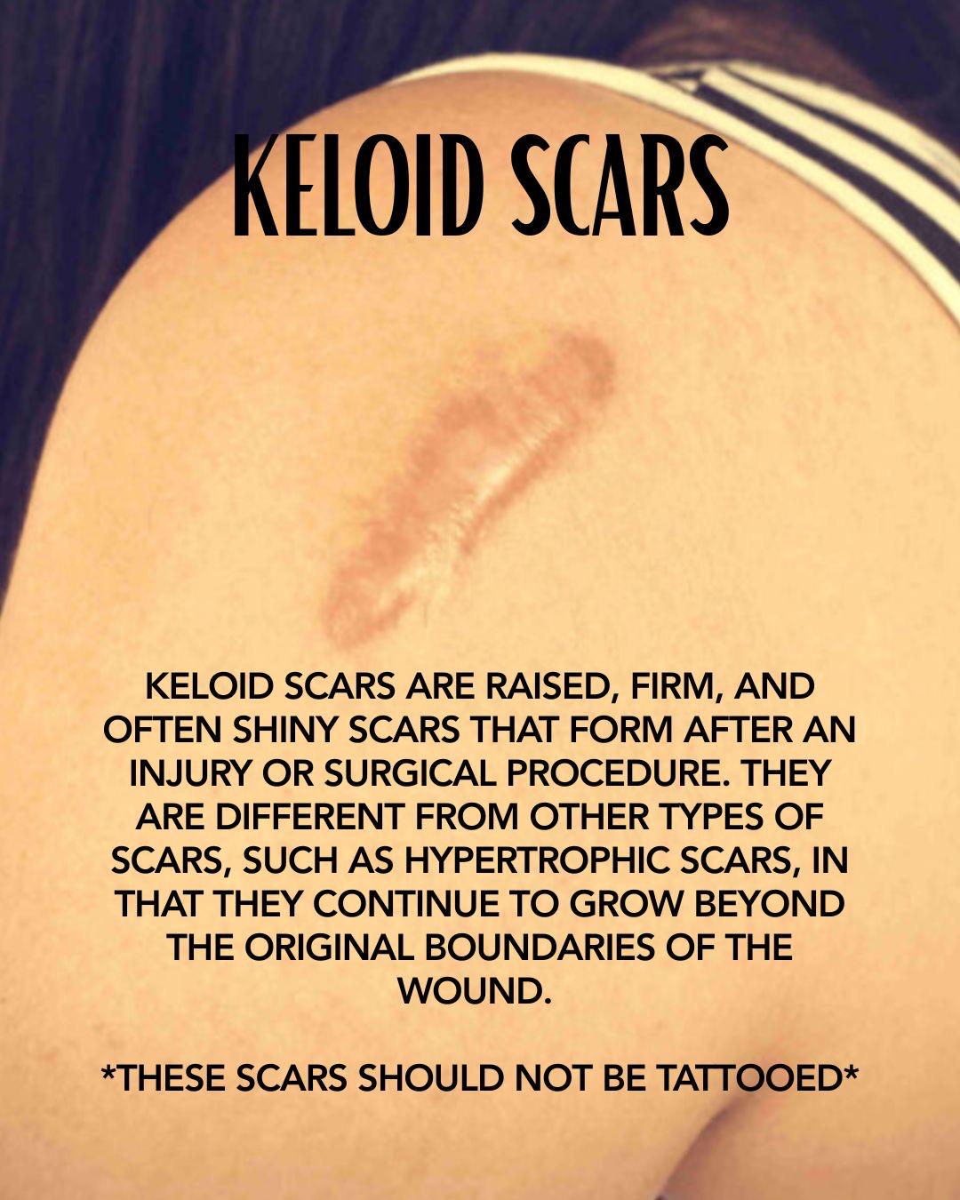 Scar Types Instagram Post Template - Etsy