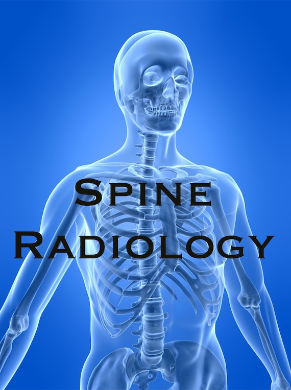 Radiology Notes SPINE - Etsy