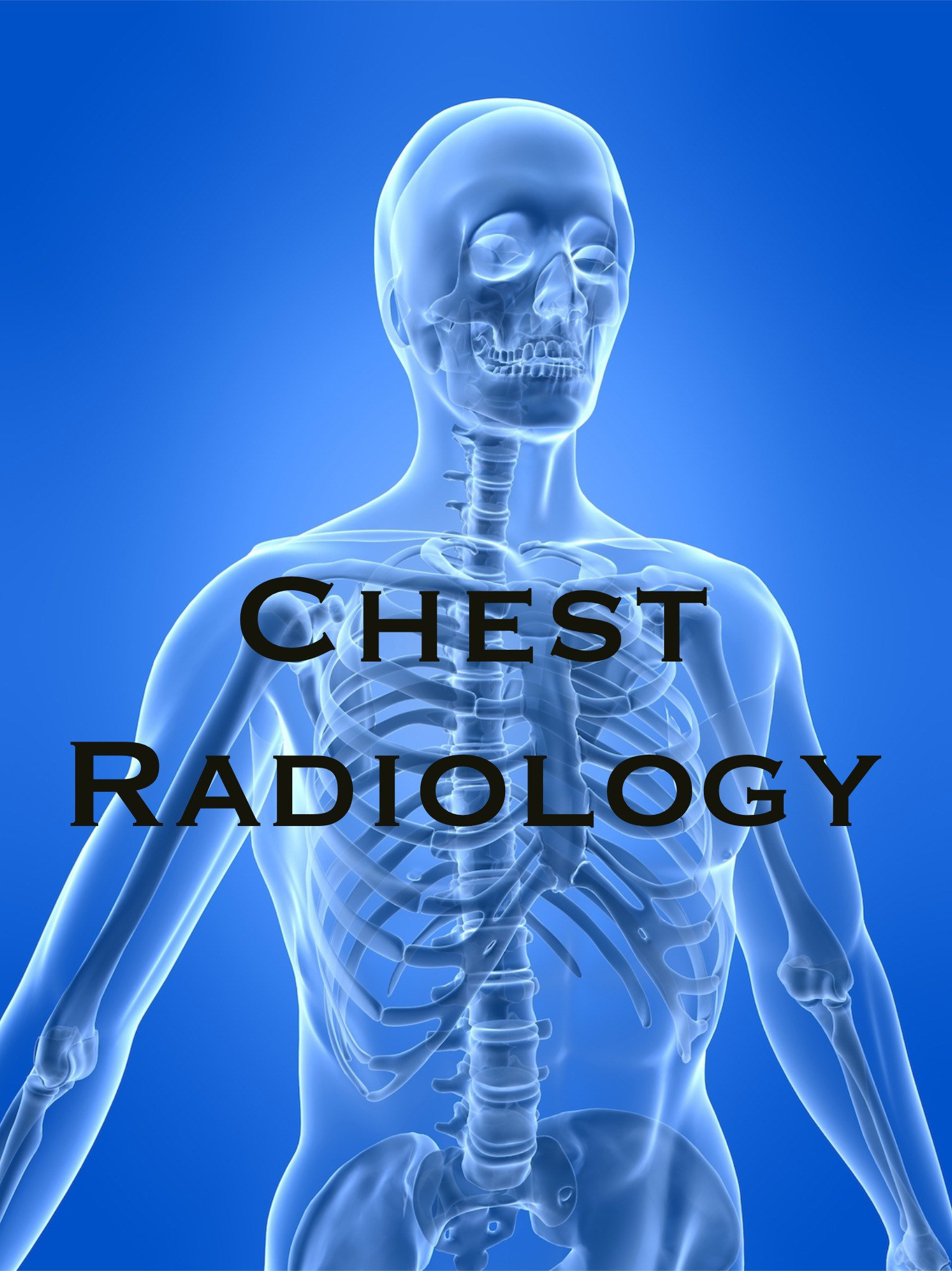 Radiology Notes - CHEST - Etsy