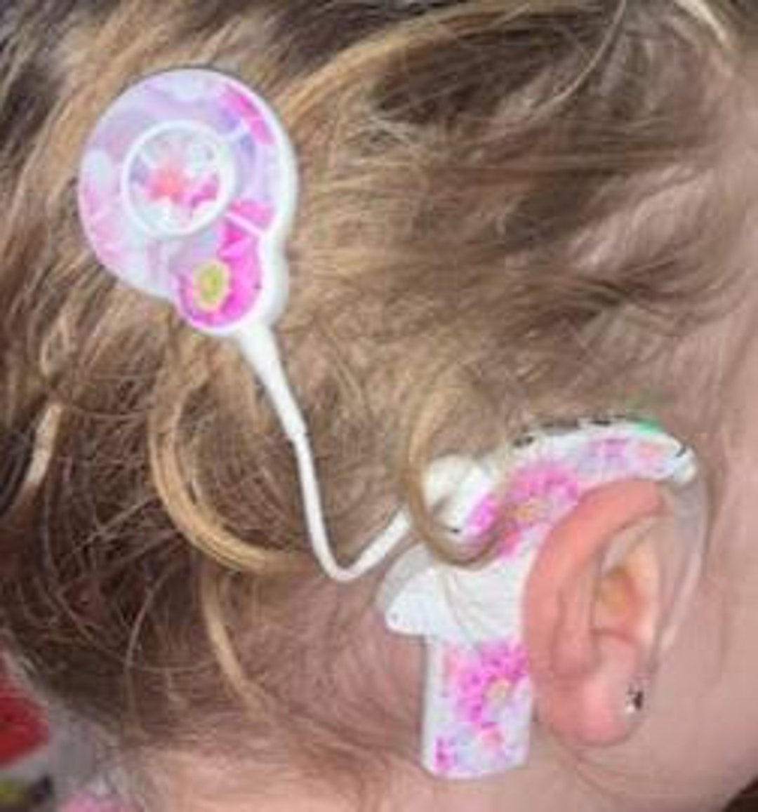 Cochlear N7 & N8 Sticker Pink Floral - Etsy Australia