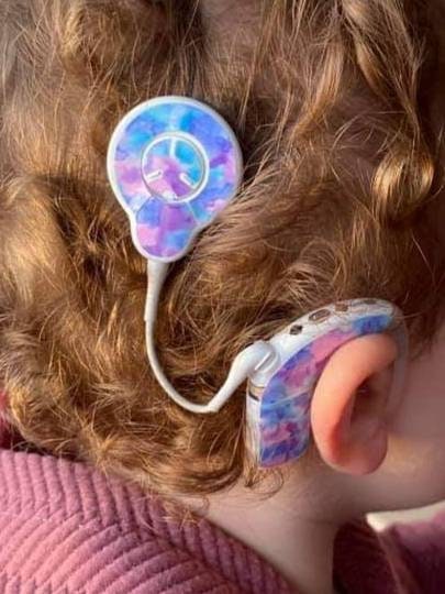 Cochlear N7 & N8 Sticker Marble - Etsy Australia
