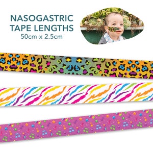 Ng Tube, Nasogastric or Oxygen Tube Adhesive Tape Length Fluro MIX Pack ...