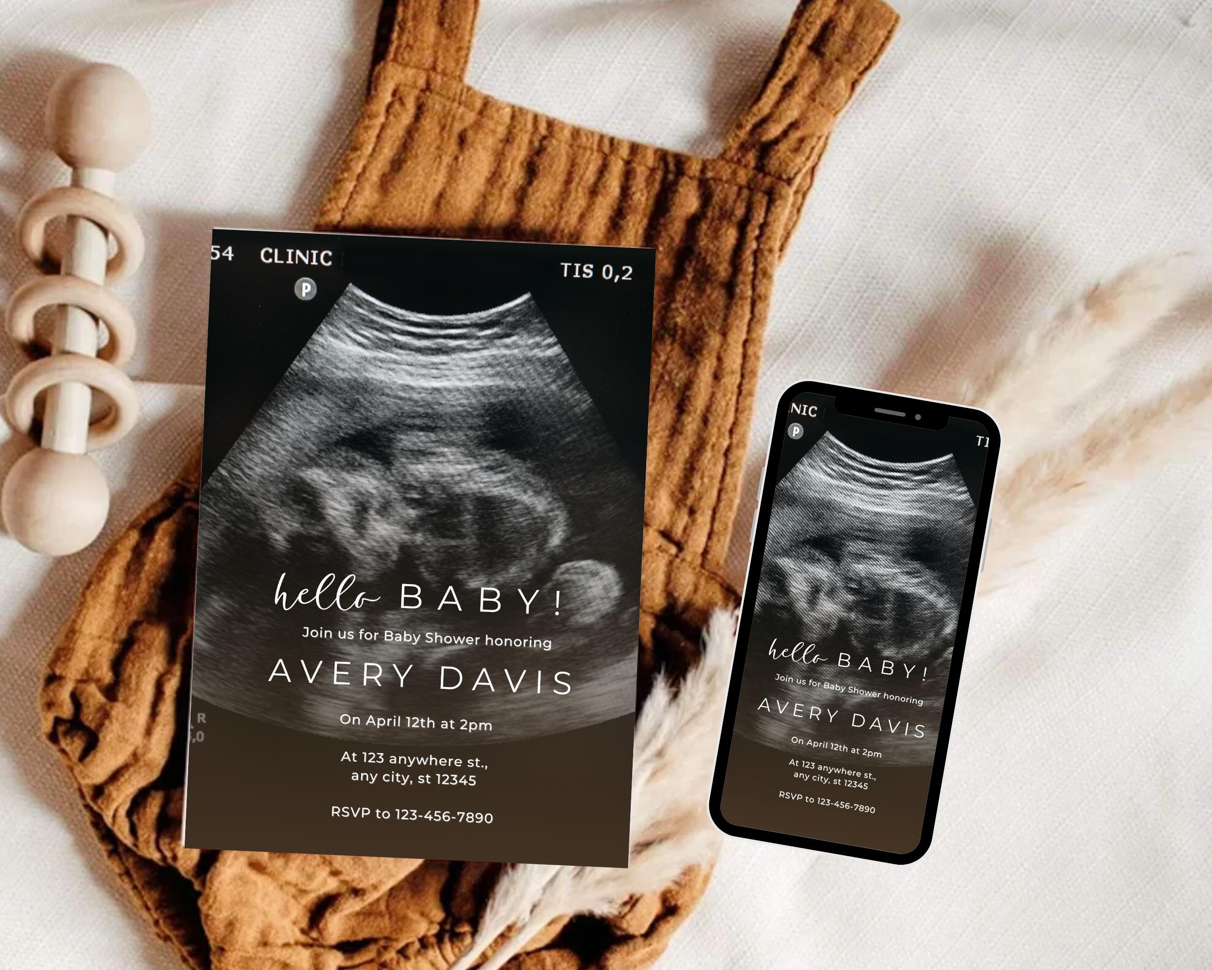 Ultrasound Baby Shower Invitation, Editable Sonogram Baby Shower Invite ...