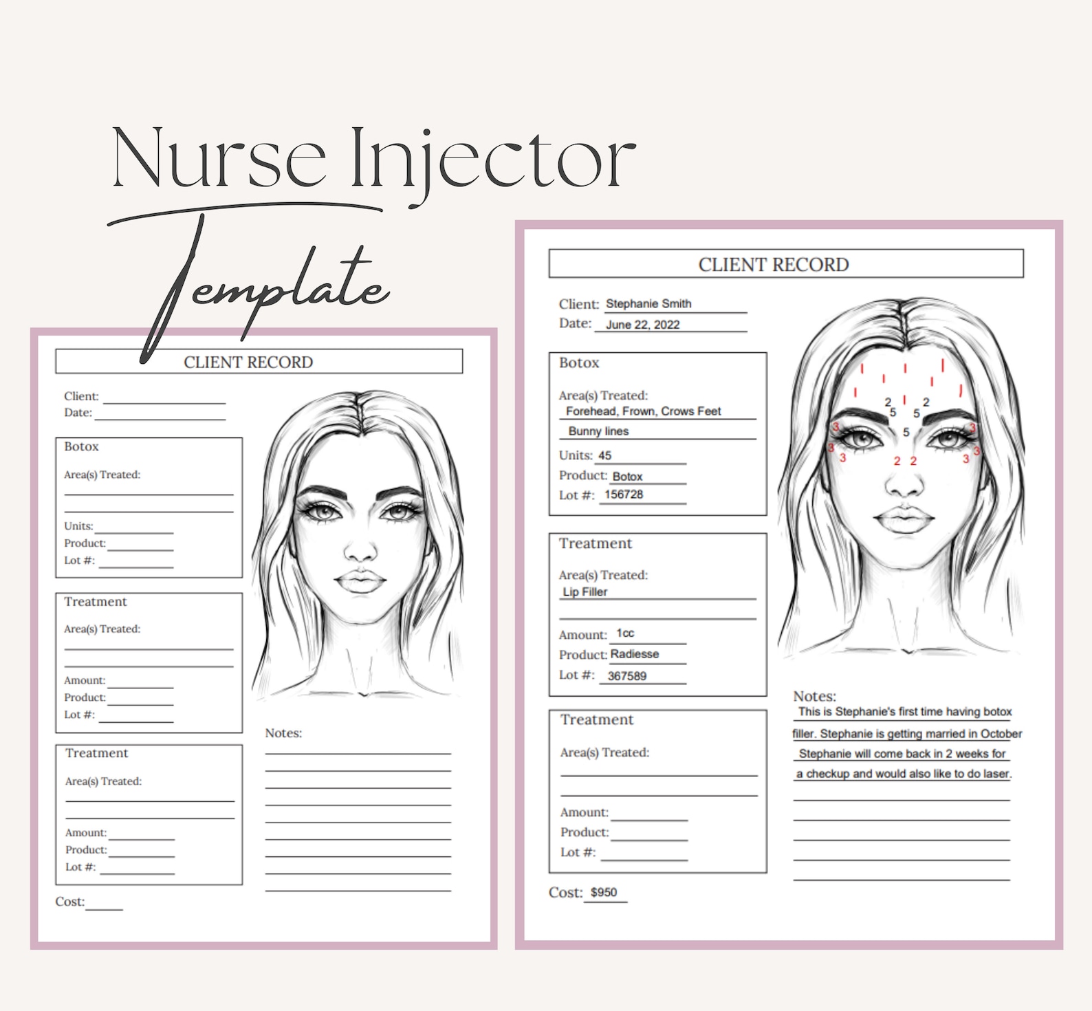 Nurse Injector Digital Download Template Goodnotes, Botox Form for ...