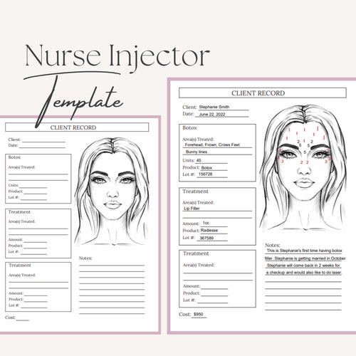 Nurse Injector Digital Download Template Goodnotes Botox Form - Etsy