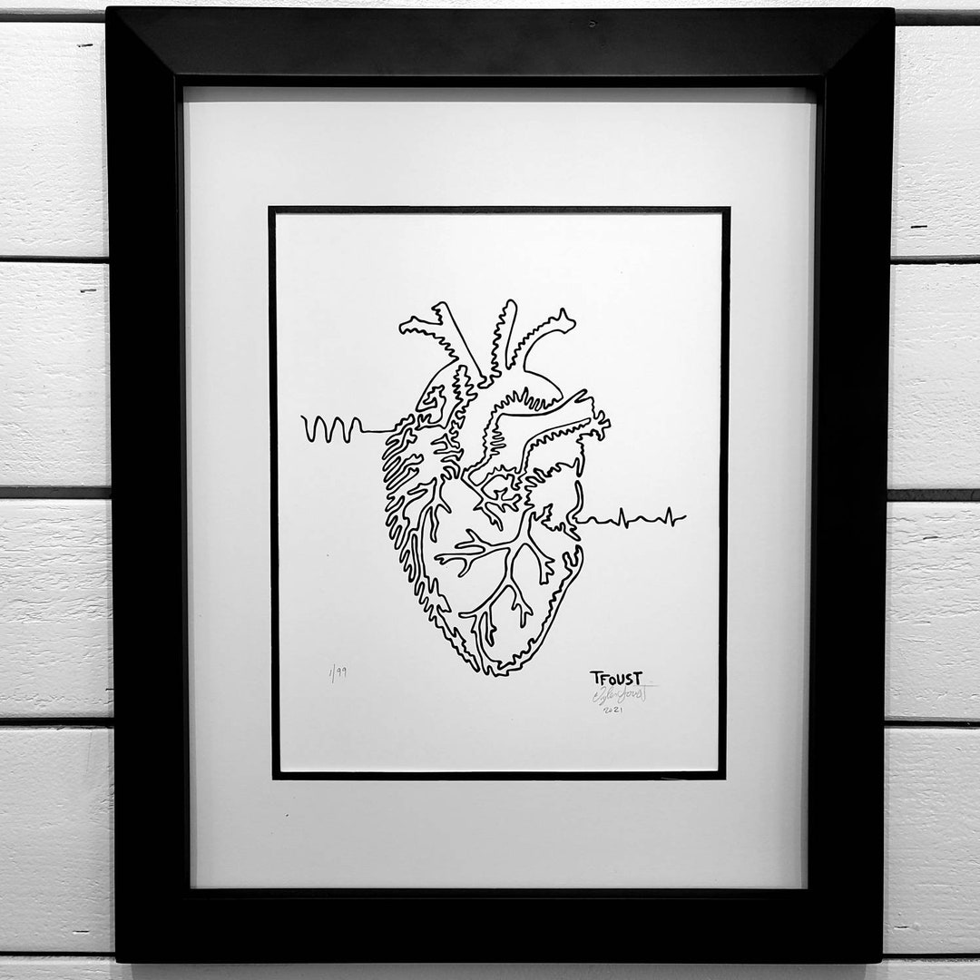 One Line Cardiac Conversion Numbered Print by Tyler Foust - Etsy