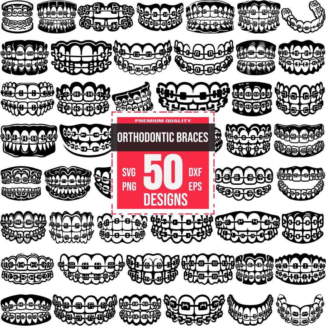 Orthodontic Braces SVG Bundle | 50 Dental & Smiley Designs | Dentist ...