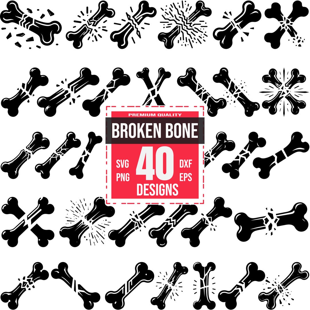 Broken Bone SVG Bundle | 40 Fracture and Injury Designs | Medical ...