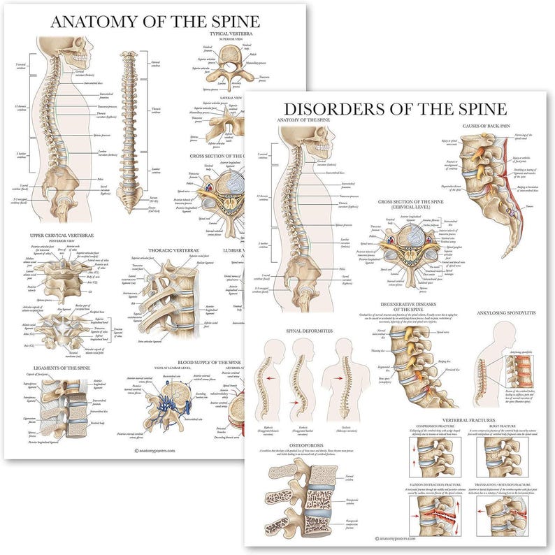 2 Pack: Anatomy of the Spine + Disorders of the Spine Poster Set - Set ...