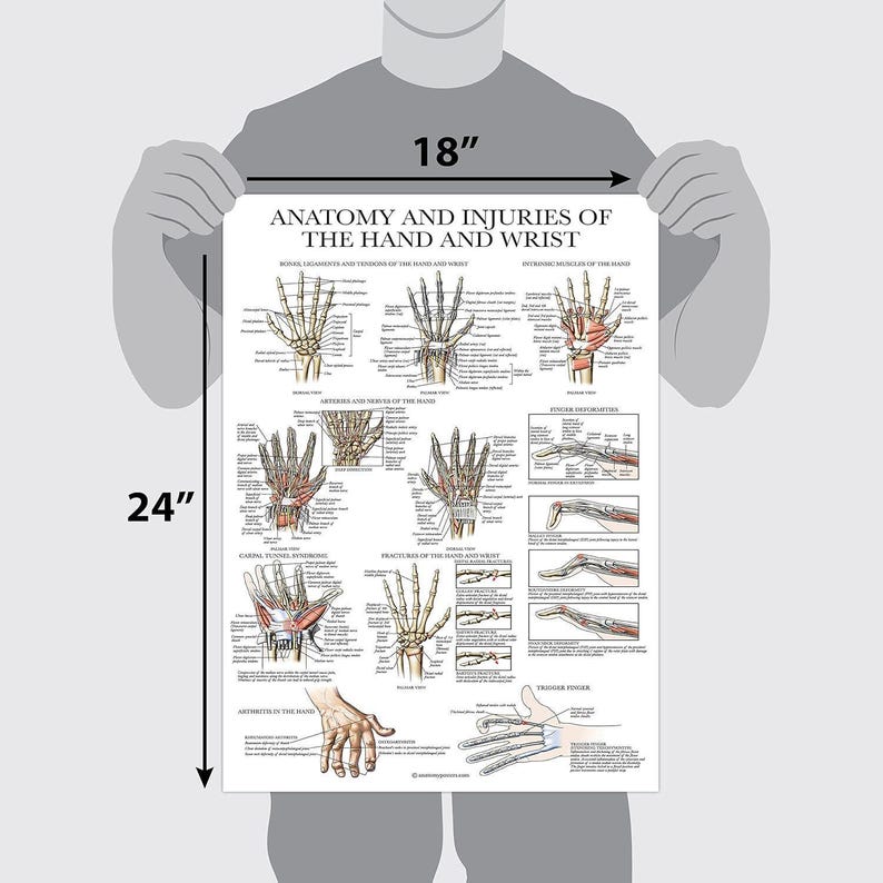 Laminated Anatomy and Injuries of the Hand and Wrist Poster - Hand and ...