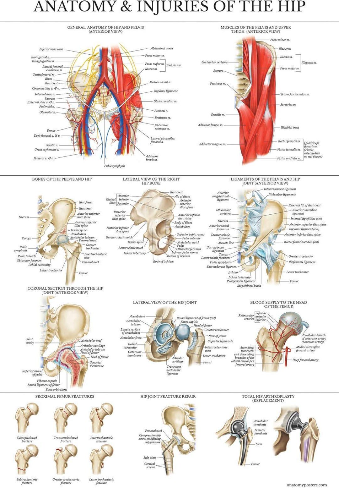Laminated Anatomy and Injuries of the Hip Poster - Hip Joint Anatomical Chart - 18" X 24" - Etsy