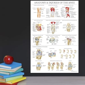 Laminated Anatomy and Injuries of the Knee Poster - Knee Joint ...