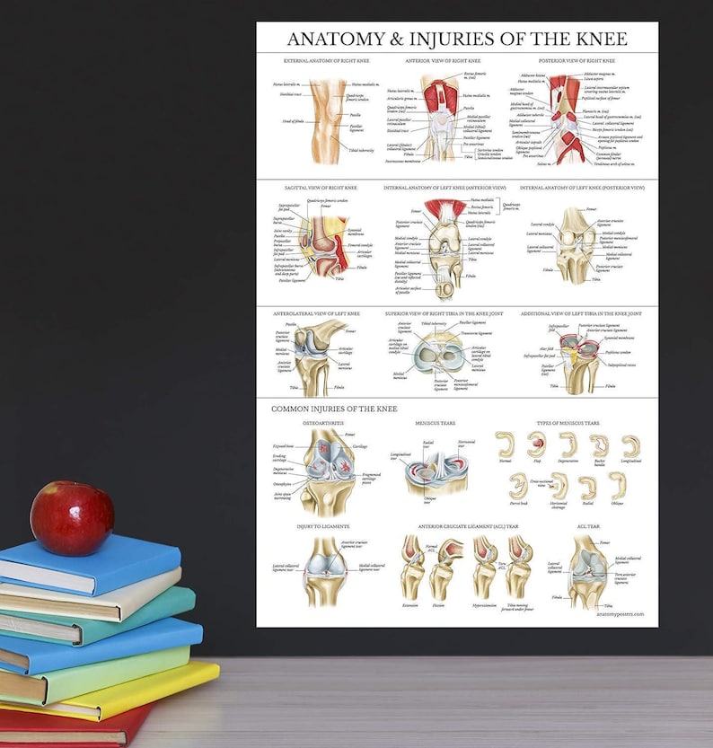 Laminated Anatomy and Injuries of the Knee Poster - Knee Joint ...