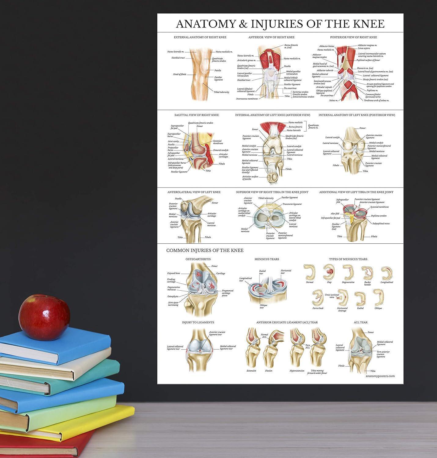 Laminated Anatomy and Injuries of the Knee Poster - Knee Joint ...