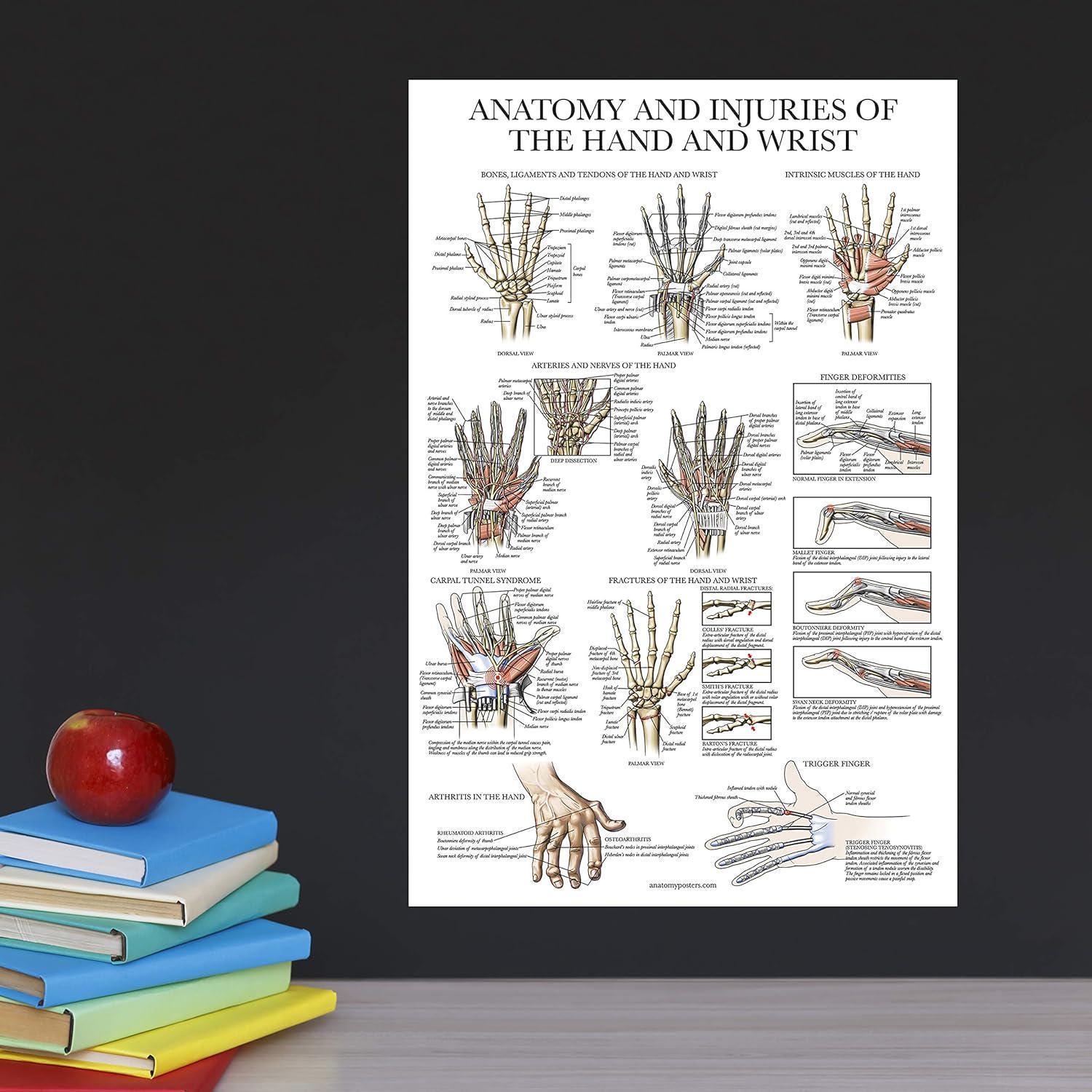 Laminated Anatomy and Injuries of the Hand and Wrist Poster - Hand and ...