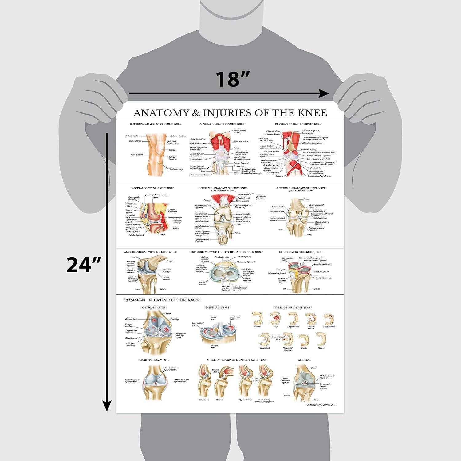 Laminated Anatomy and Injuries of the Knee Poster - Knee Joint ...