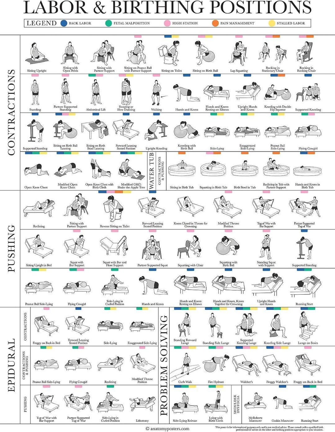 Labor Positions Poster - Birthing Positions Chart - Childbirth ...