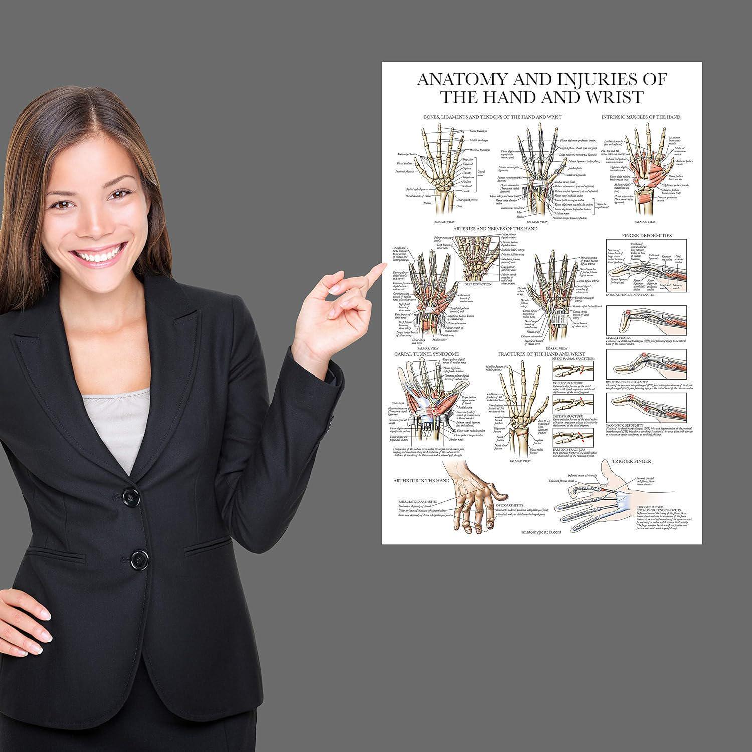 Laminated Anatomy and Injuries of the Hand and Wrist Poster - Hand and ...
