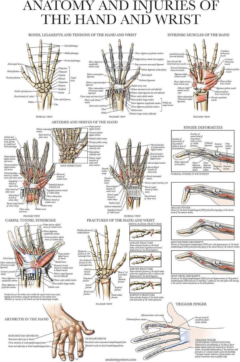 Laminated Anatomy and Injuries of the Hand and Wrist Poster - Hand and ...