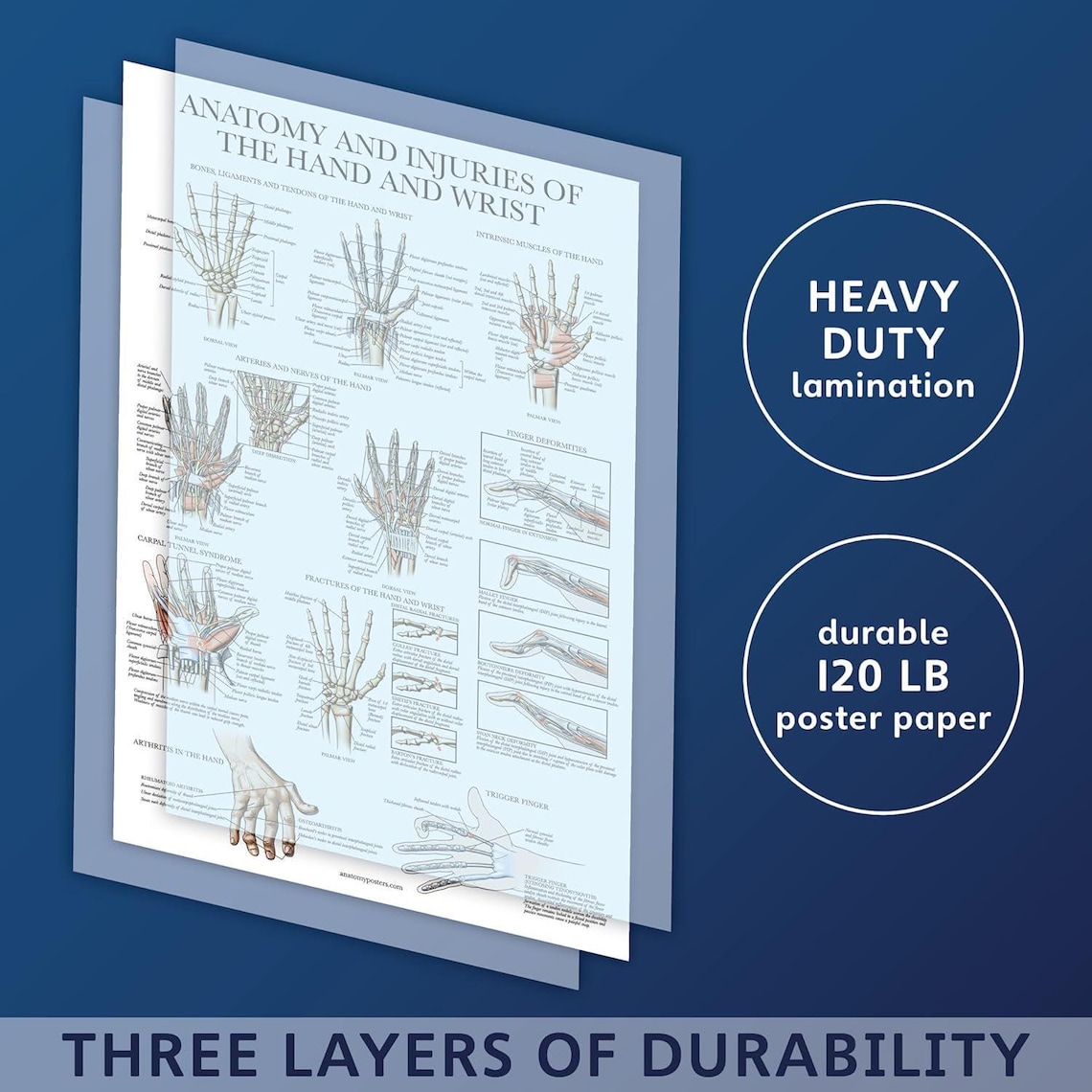 Laminated Anatomy and Injuries of the Hand and Wrist Poster - Hand and ...