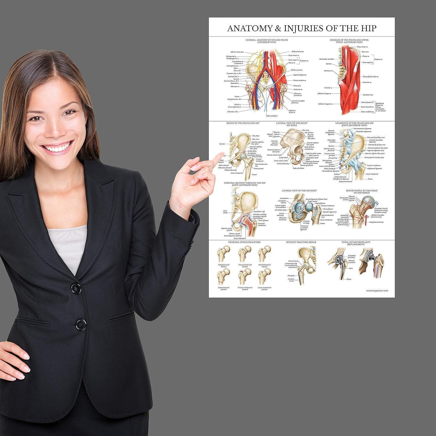 Laminated Anatomy and Injuries of the Hip Poster - Hip Joint Anatomical ...