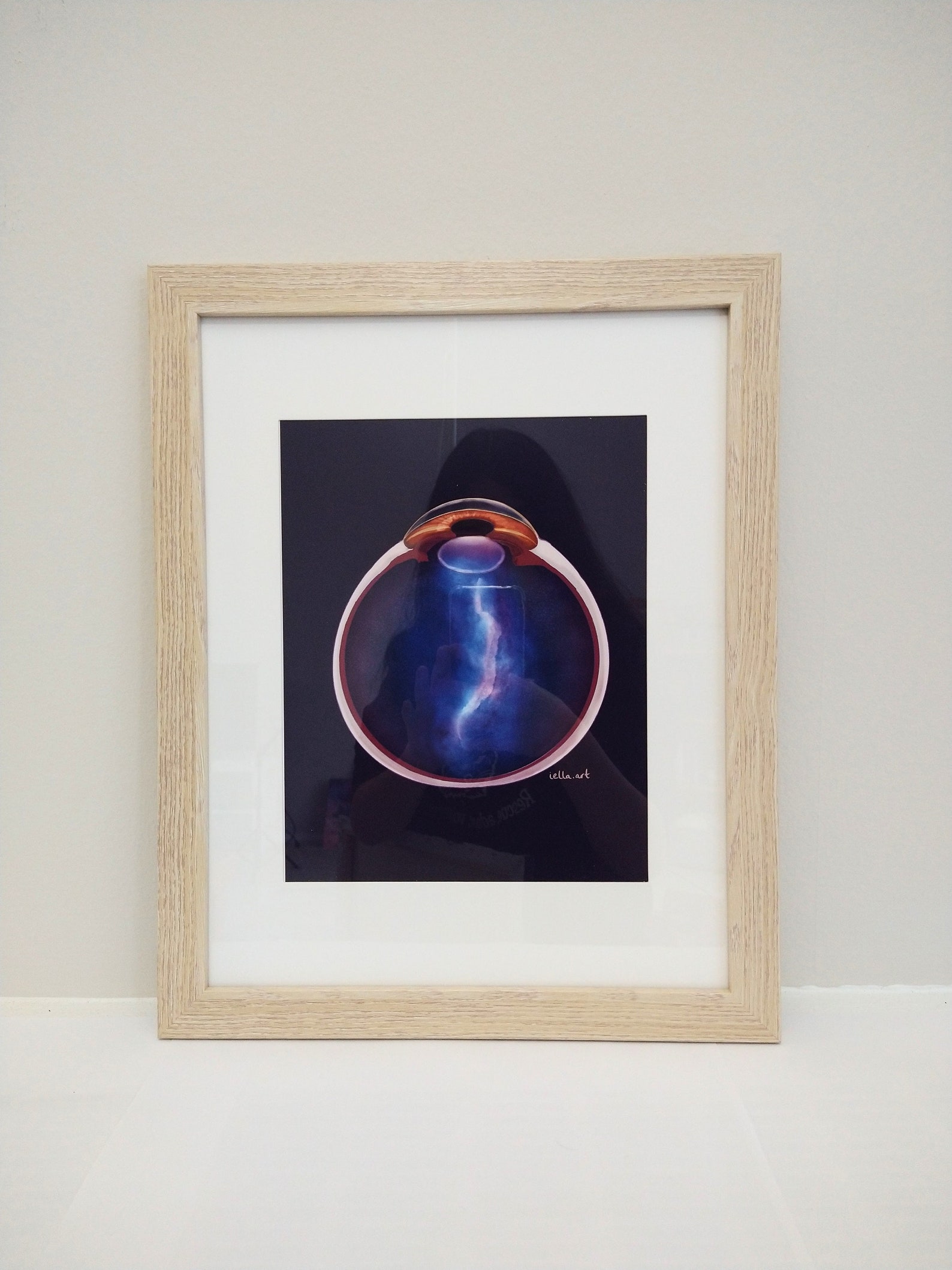 Starry Eyes Print Optometry / Ophthalmology Print Unique Eyeball Art - Etsy